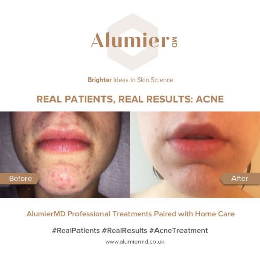 Alumier - The Skin Boutique